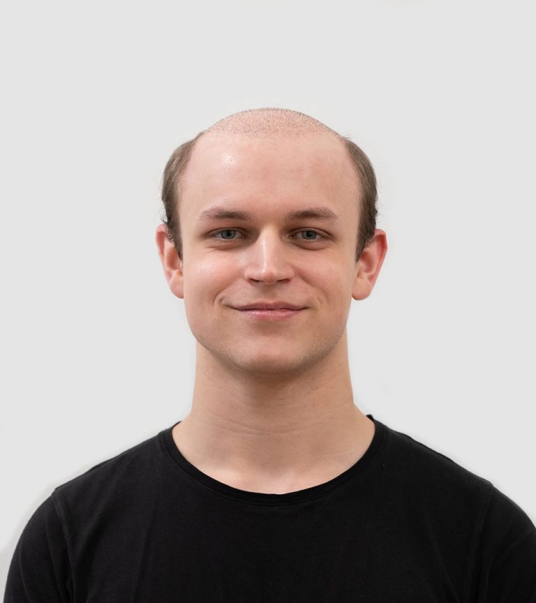 ᐅ Haarsystem aus Hamburg von Hairsystems Heydecke